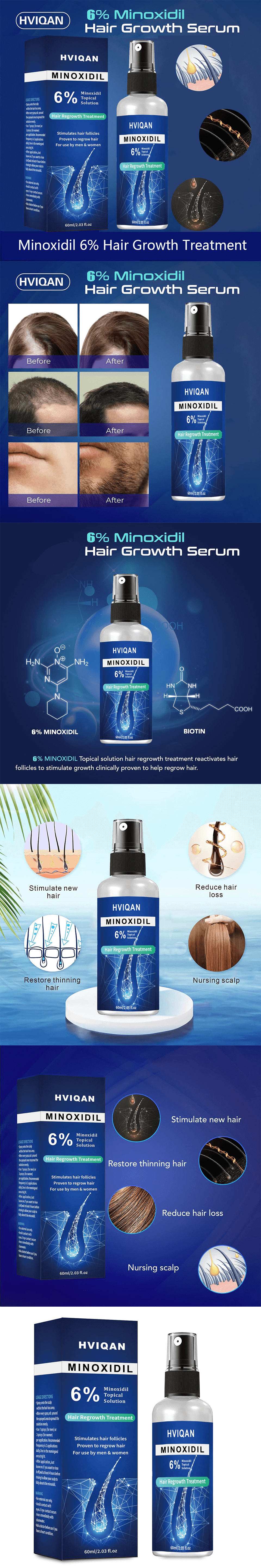 Hviqan 6% Minoxidil For Beard Growth And Hair Growth Serum: Powerful ...